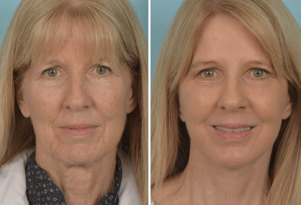 Test Gallery - MobleyMD