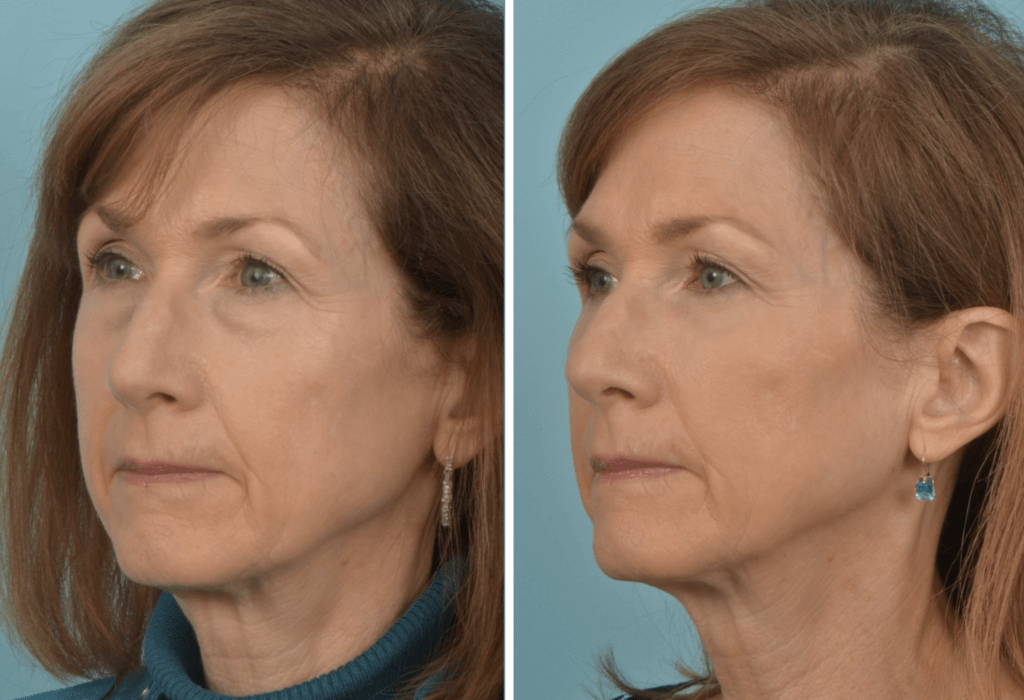 08 Cosm Fat Case 2 - Mobley MD